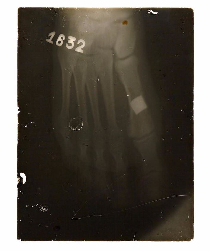 Hemingway X-ray – Biblioklept